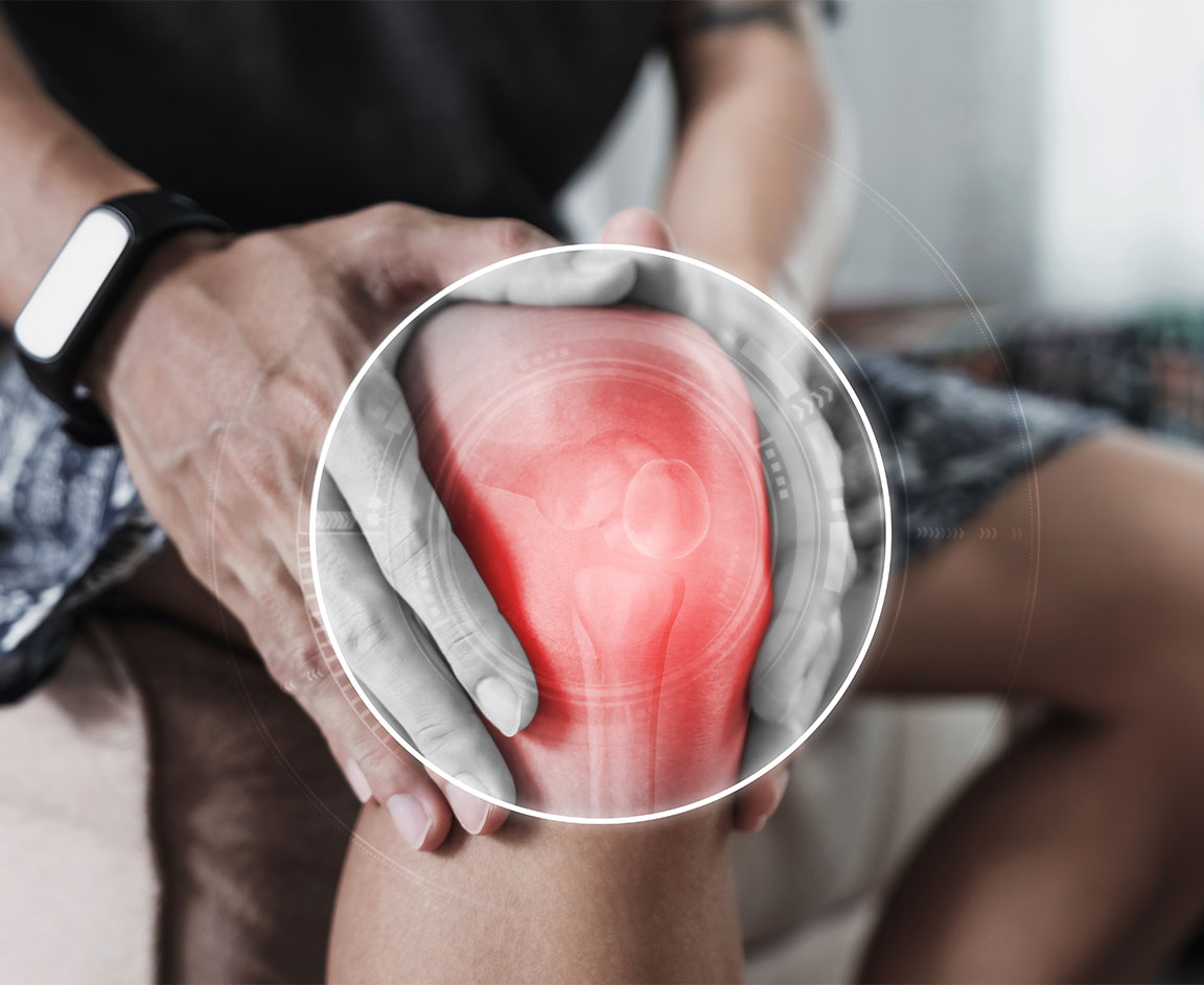 Болка во преден дел на коленото - Slavej